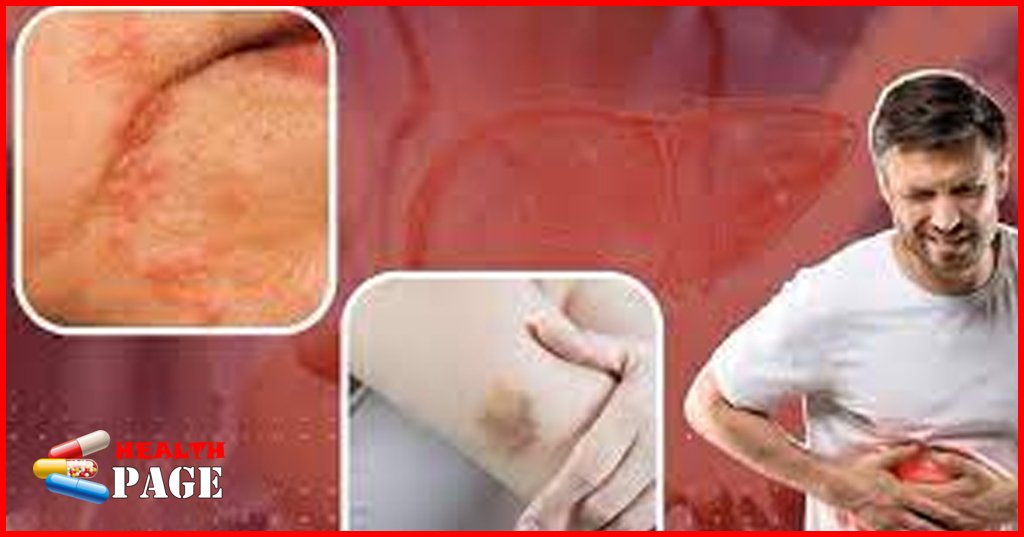 Liver problems can be seen from the palms, skin, and complexion