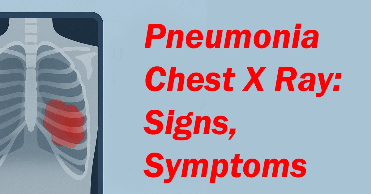 Pneumonia Chest X-Ray: Signs, Diagnosis & Treatment Guide